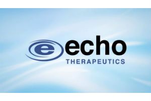 Echo Therapeutics appoints Alan Schoenbart as chief financial officer ...